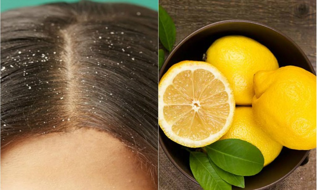 Remedii naturale impotriva matretii | Produse Bio